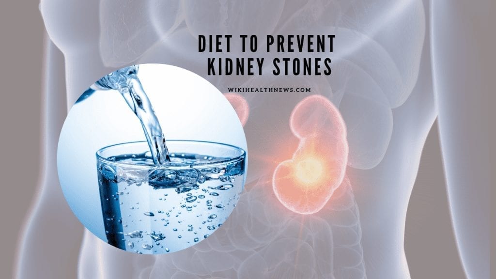 Plan Your Diet To Prevent Kidney Stones - wiki Health News