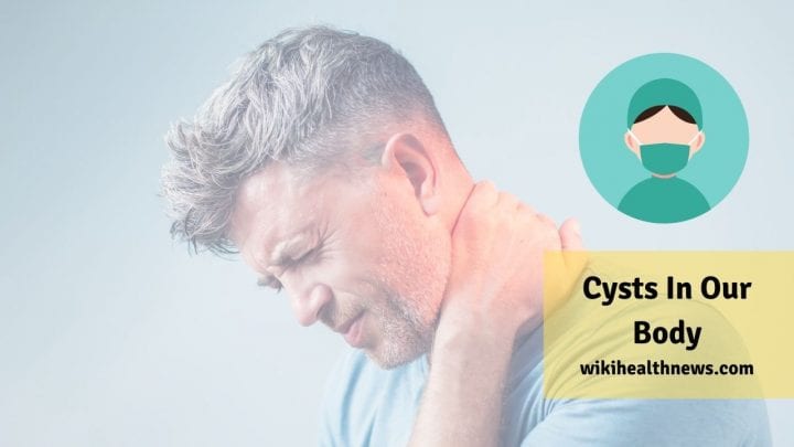 Types of Simple Cysts in Our Body - wiki Health News