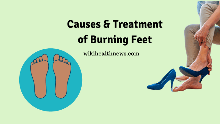 Burning Feet: Causes & Treatment - wiki Health News
