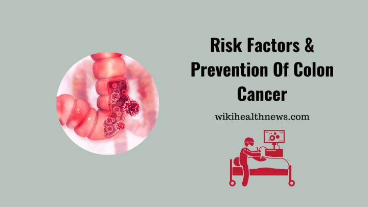 Risk Factors For Colon Cancer & Prevention - wiki Health News