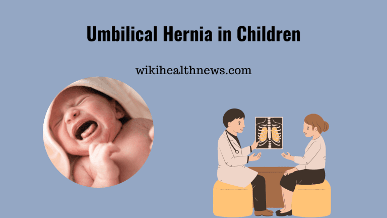 Causes Of Umbilical Hernia In Children - wiki Health News