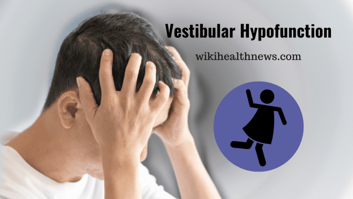 Vestibular Hypofunction: Symptoms and Therapy - wiki Health News