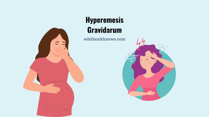 Hyperemesis Gravidarum Needs Medical Help - wiki Health News